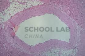 Prepared Microscope Slide - Aorta and Vein T.S.