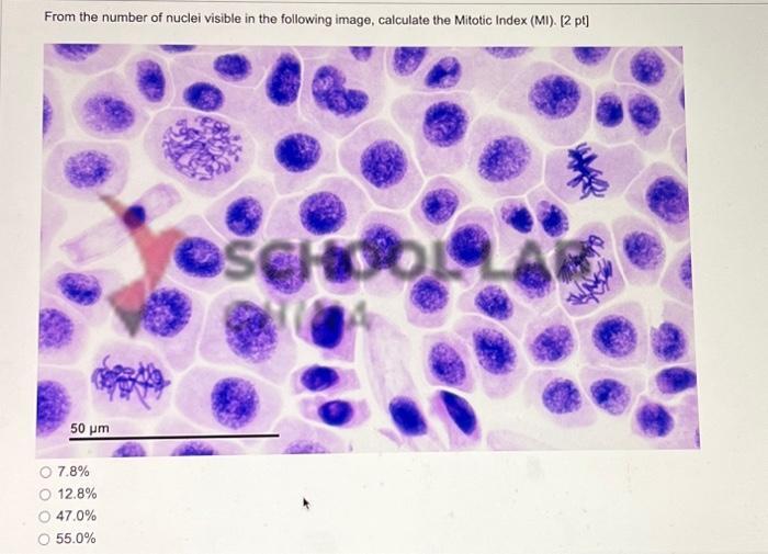 Prepared Microscope Slide Set - Mitosis and Meiosis - Set 1 - Set of 6 ...
